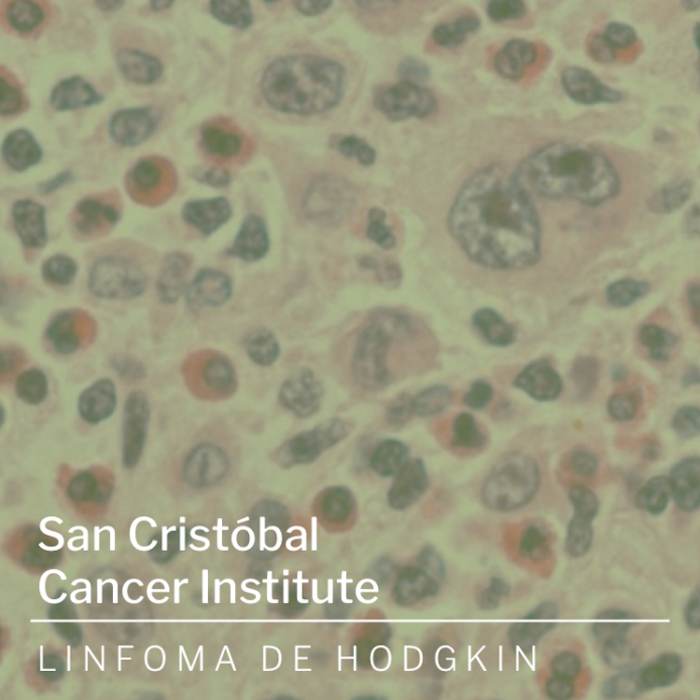 Información sobre Linfoma de Hodgkin - San Cristóbal Cancer Institute